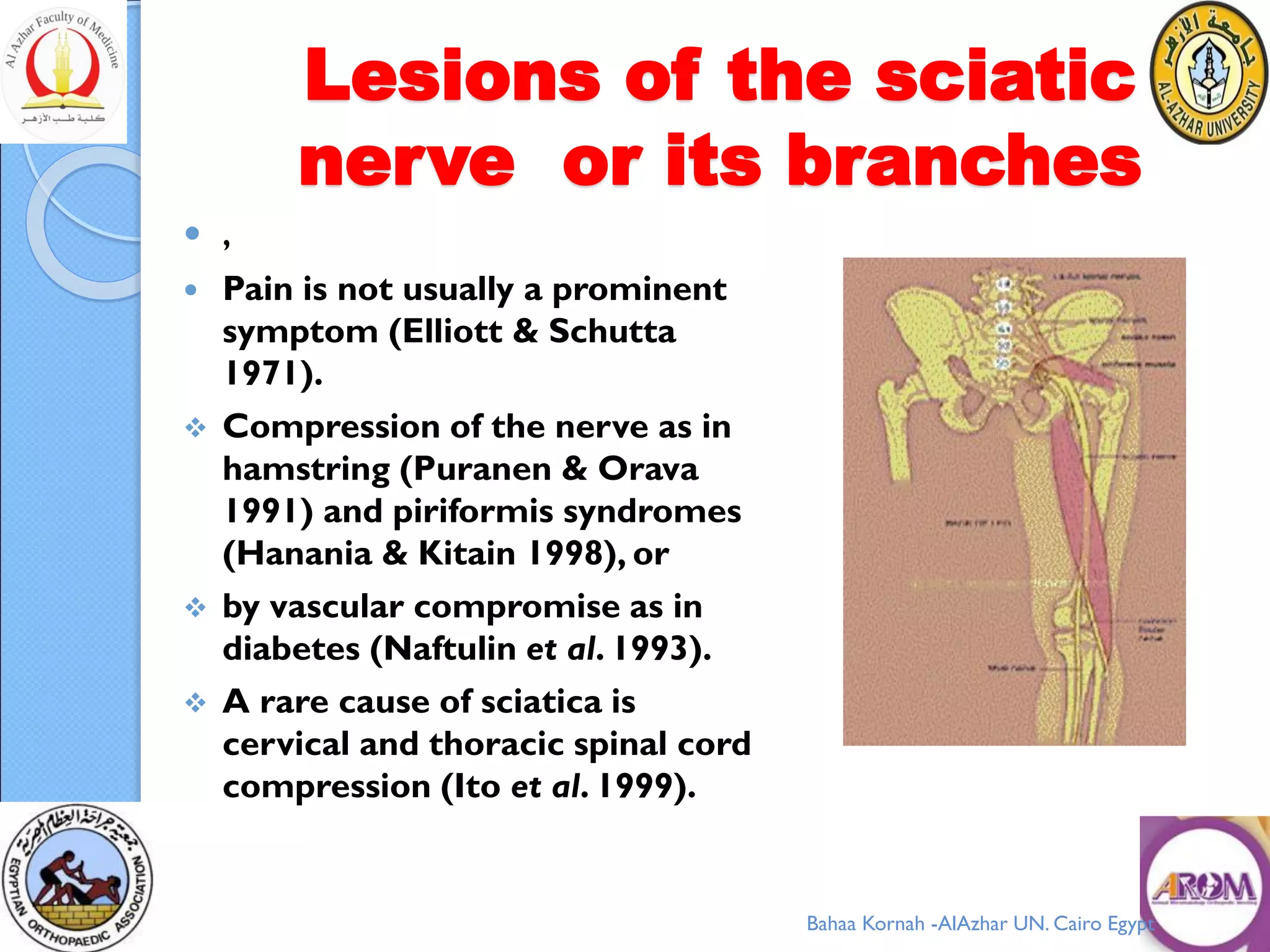 Extra spinal causes of sciatica and a causes algorithm | PPT