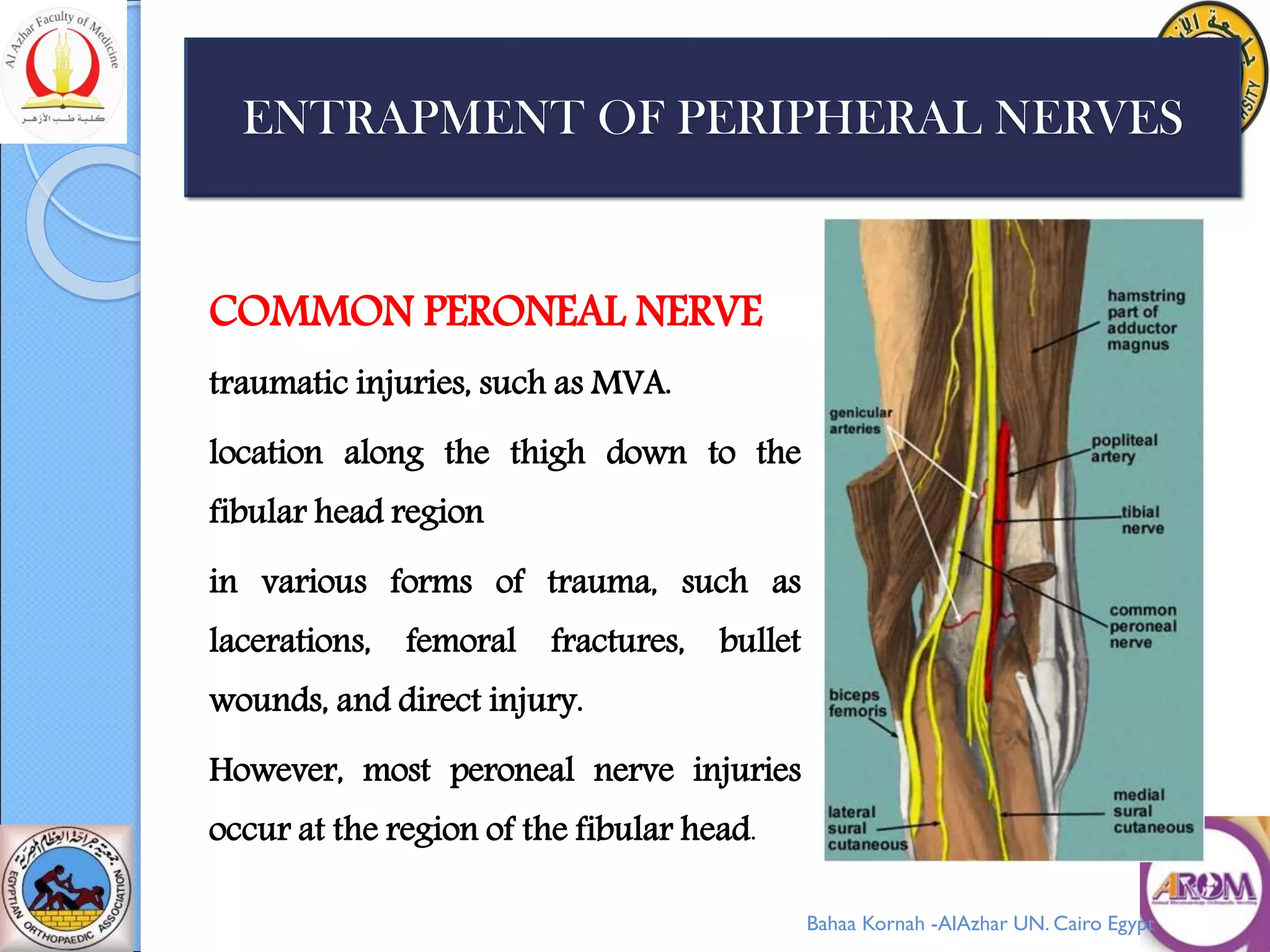 Extra Spinal Causes Of Sciatica And A Causes Algorithm Ppt 5385