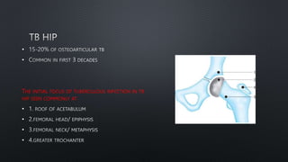 extra spinal tb ug.pptx