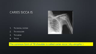 extra spinal tb ug.pptx