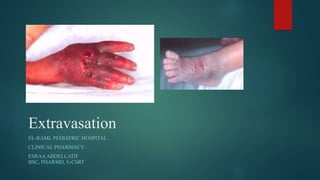 Extravasation.pptx