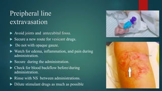 Extravasation.pptx