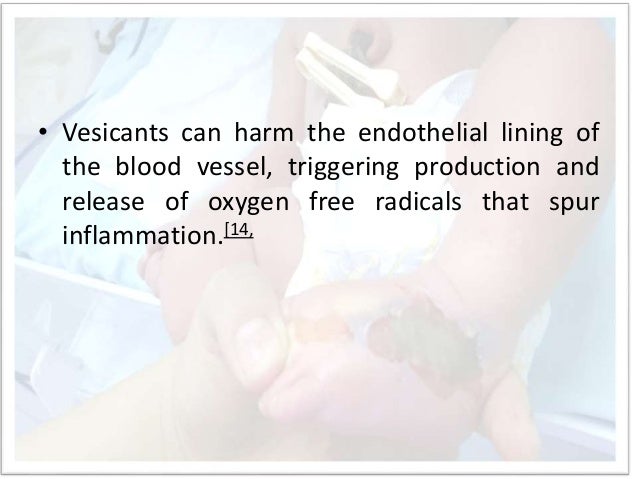 Extravasation In Neonate