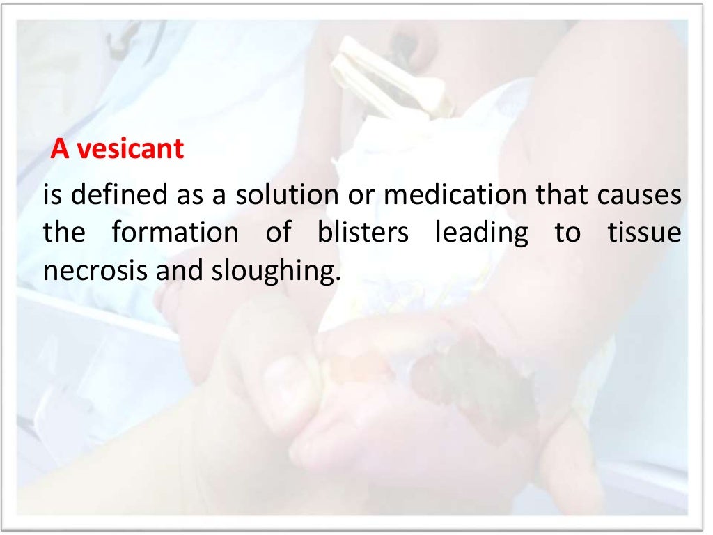 Extravasation In Neonate