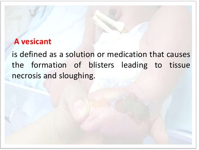 Extravasation In Neonate