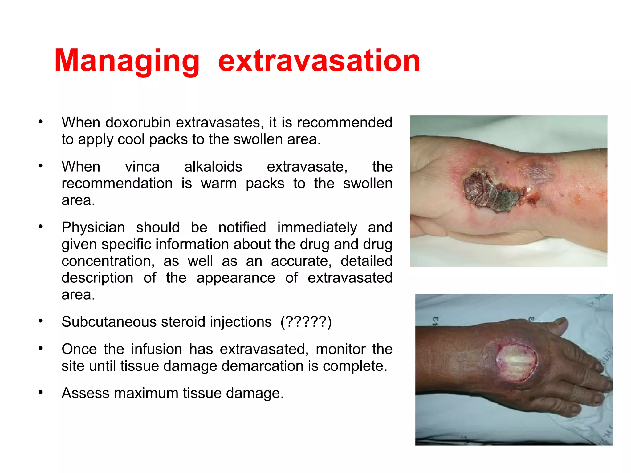 Extravasation management (1) (1) | PPT