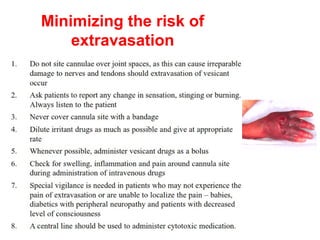 Extravasation management (1) (1) | PPT