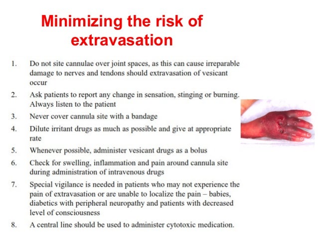 Extravasation management (1) (1)
