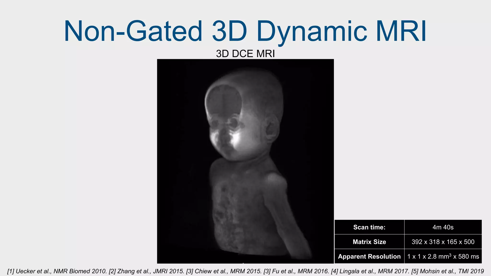 Extreme MRI: Super-High-Res Dynamic Volumetric MRI from Continuous Non ...