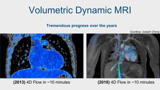 Extreme MRI: Super-High-Res Dynamic Volumetric MRI from Continuous Non ...