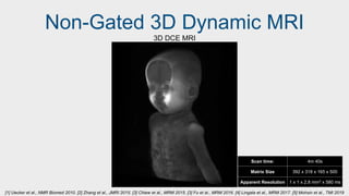 Extreme MRI: Super-High-Res Dynamic Volumetric MRI from Continuous Non ...