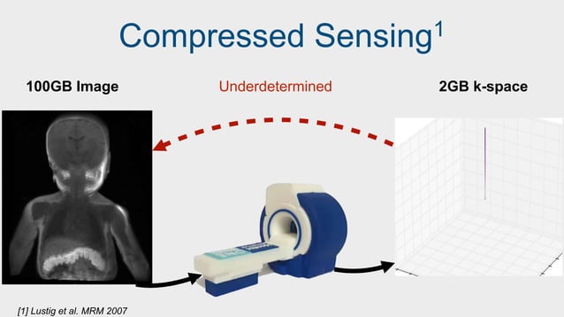 Extreme MRI: Super-High-Res Dynamic Volumetric MRI from Continuous Non ...