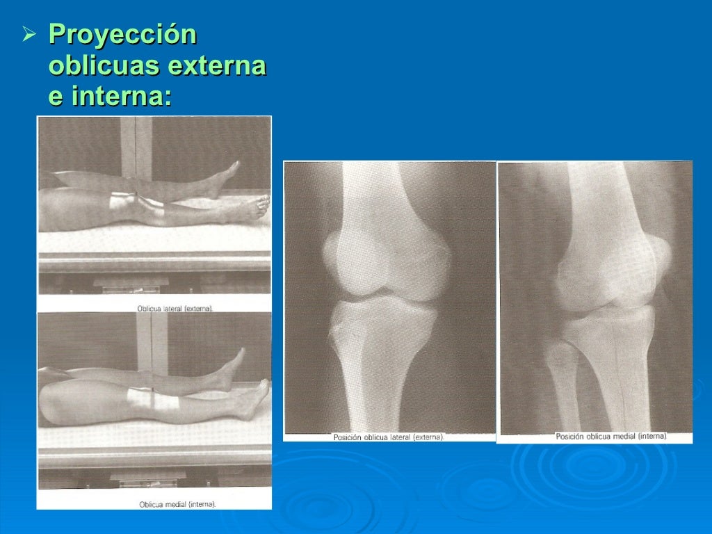 Extremidades inferiores