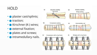 extremity injuries surgery in short for UG level | PPT
