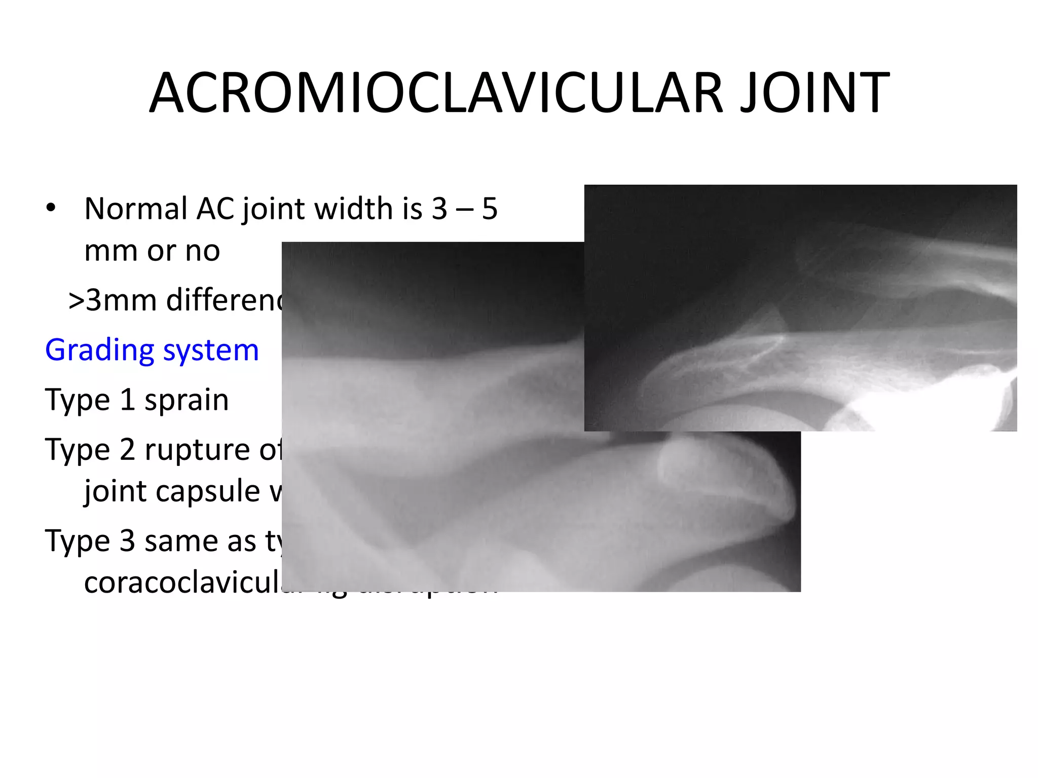 Extremity trauma | PPTX
