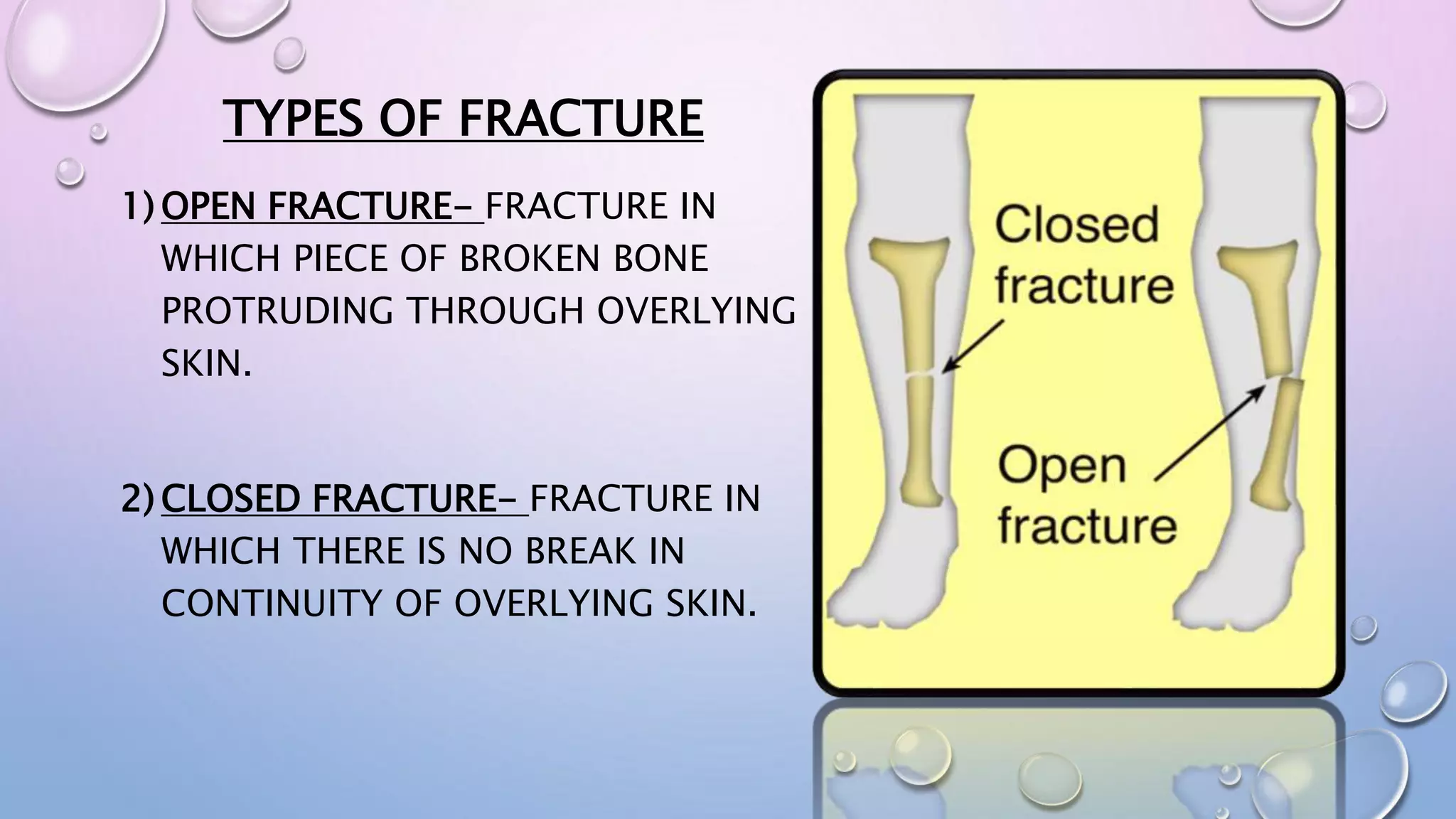 Extremity trauma part 1 | PPTX
