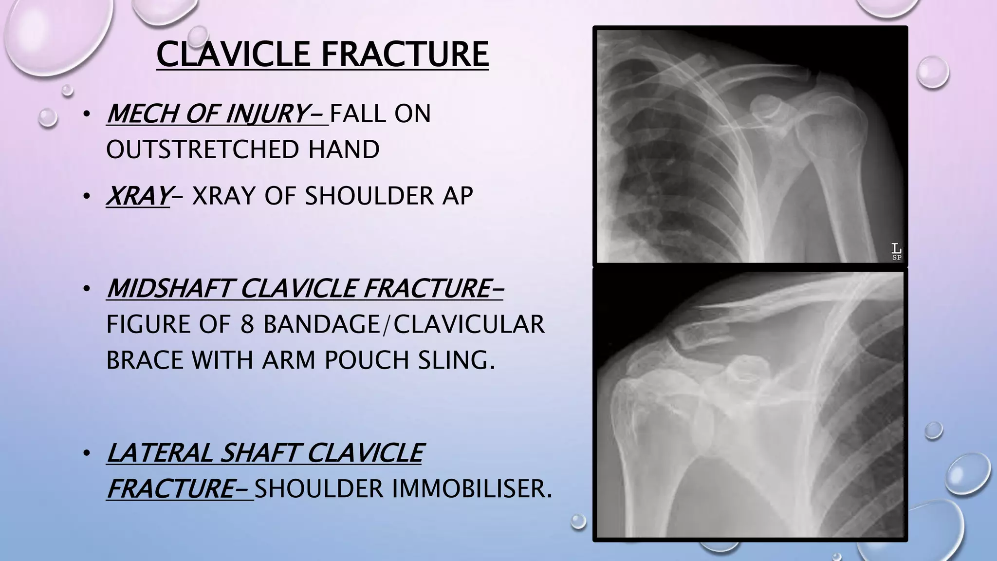 Extremity trauma part 1 | PPTX