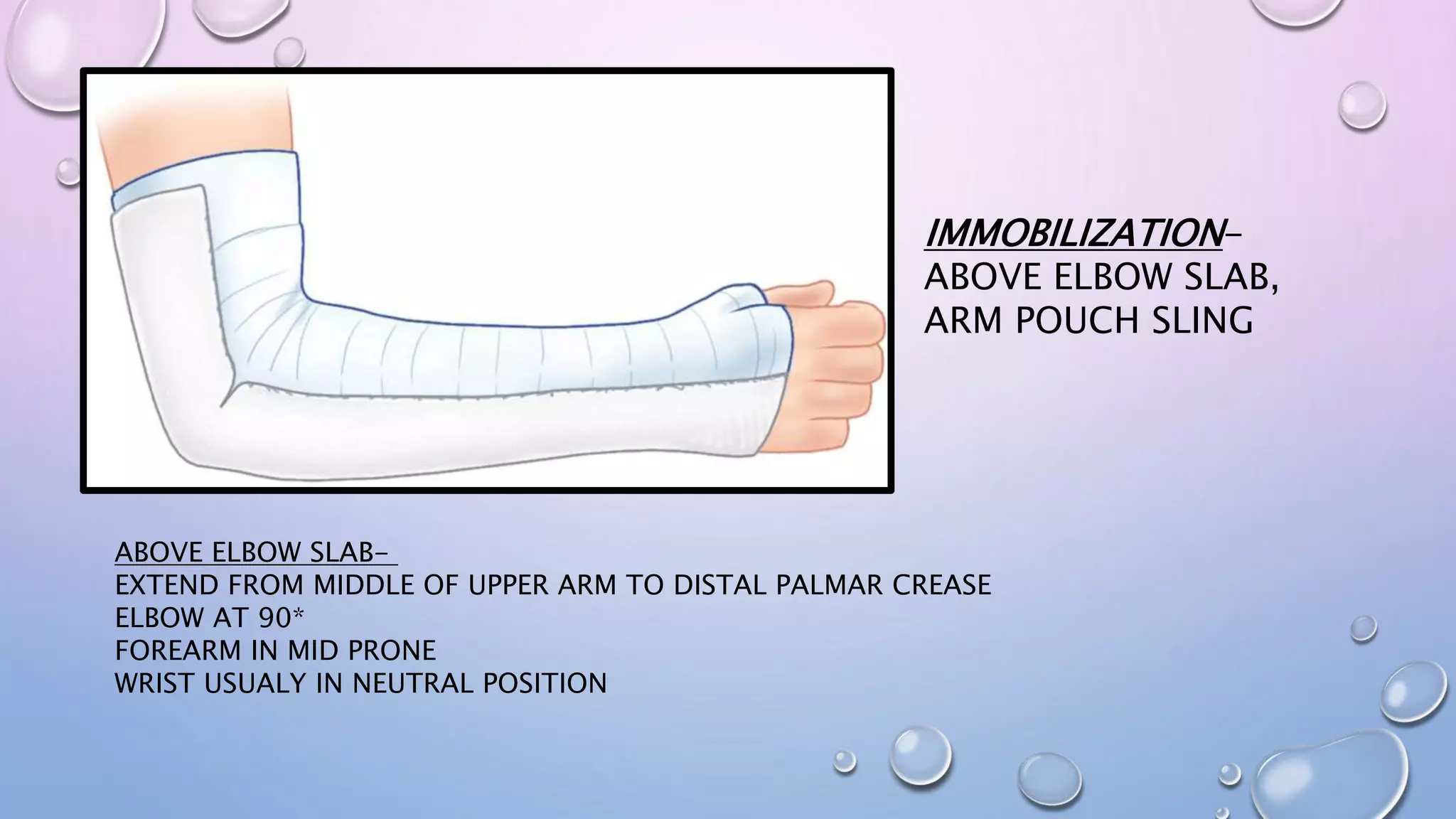Extremity trauma part 1 | PPTX