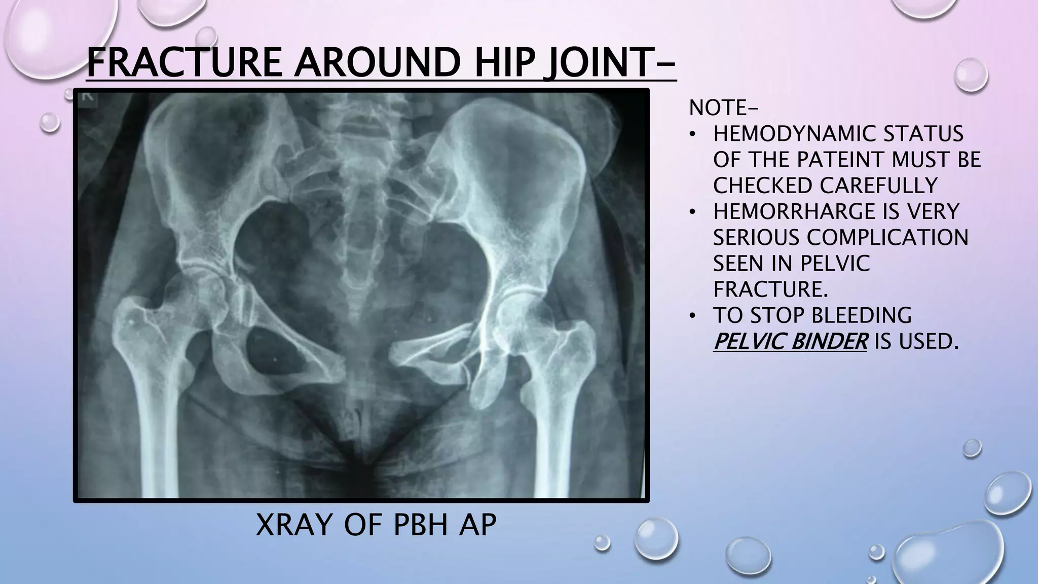 Extremity trauma part 1 | PPTX
