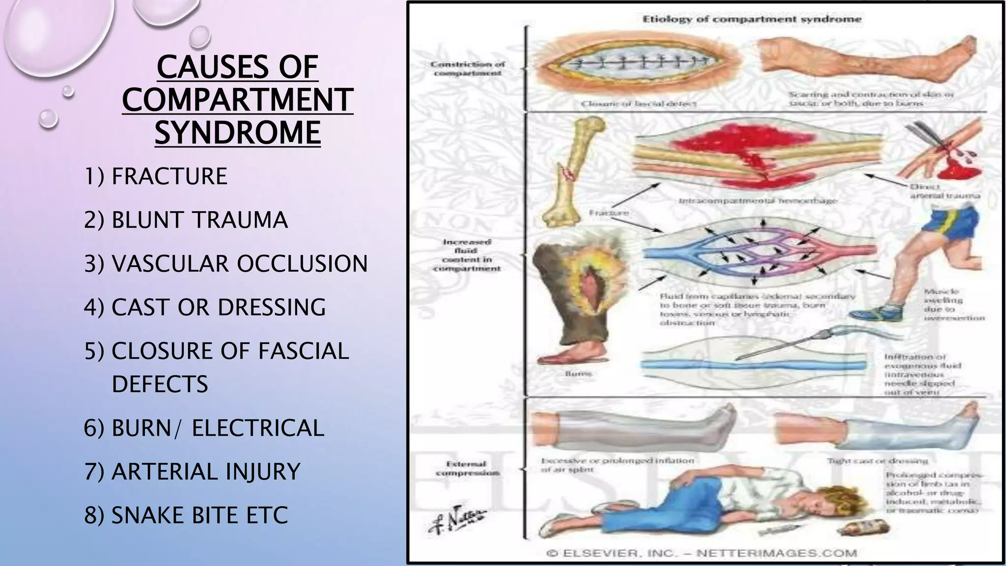 Extremity trauma part 2 | PPTX