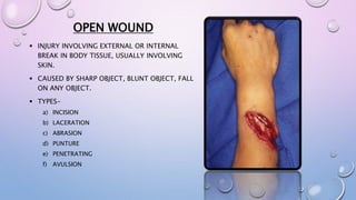 Extremity trauma part 2 | PPTX