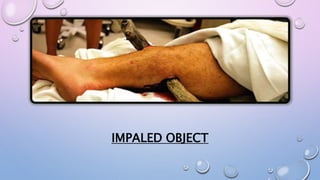 Extremity trauma part 2 | PPTX