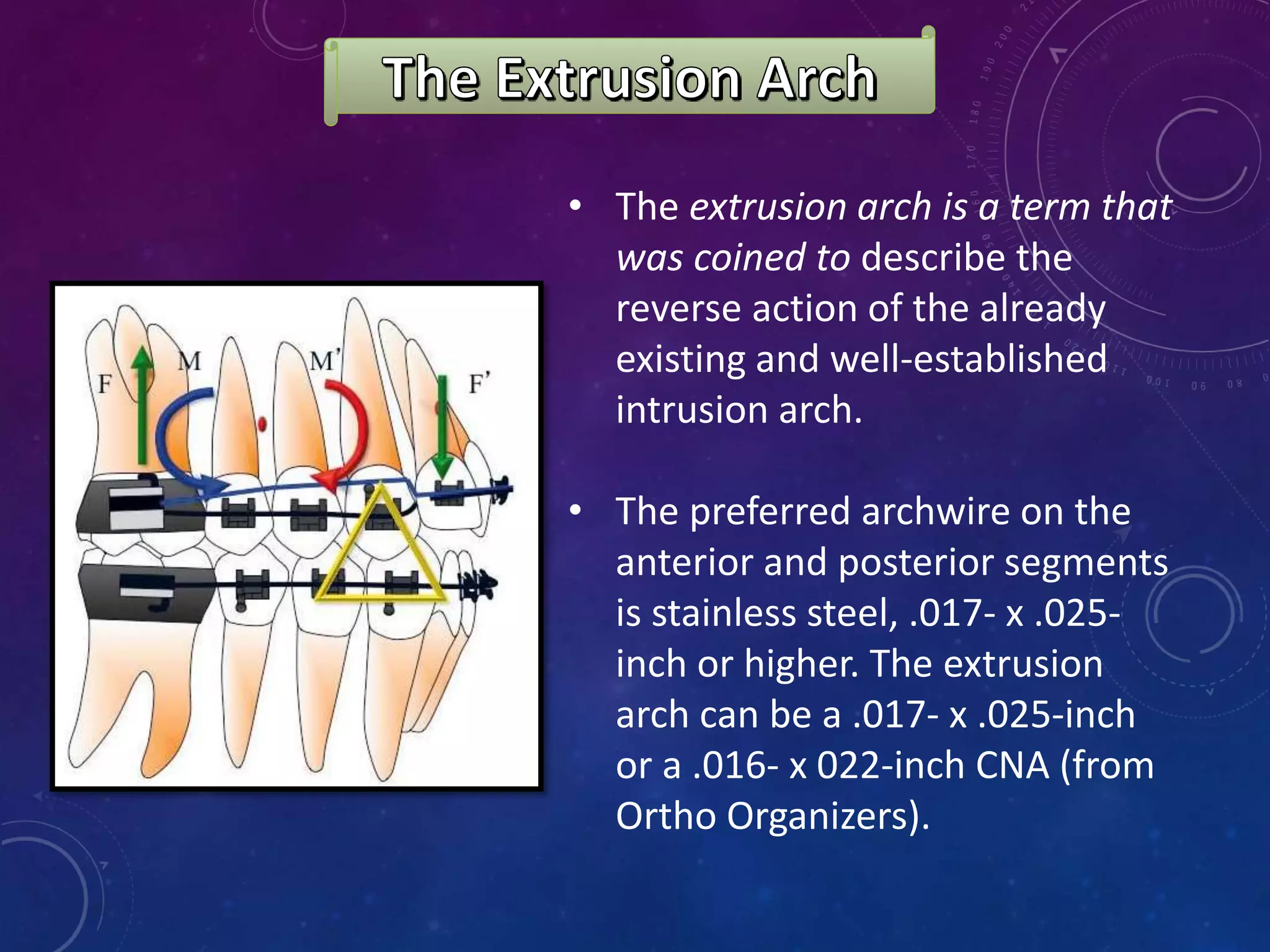 Extrusion arches of Nanda by Dr Maher Fouda | PPTX