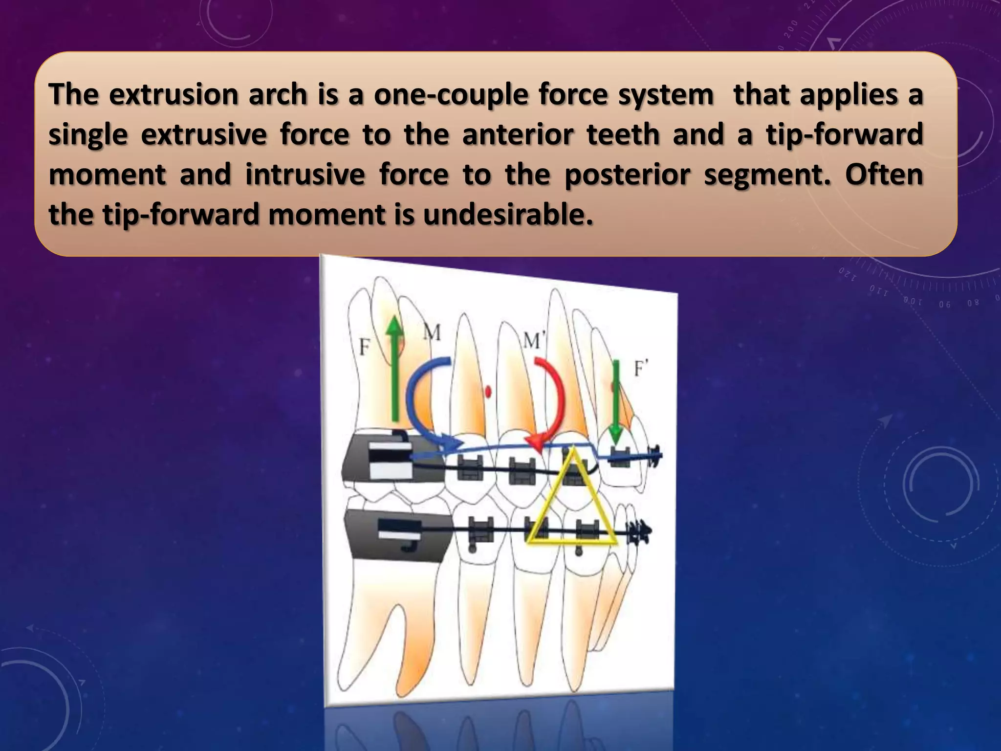 Extrusion arches of Nanda by Dr Maher Fouda | PPTX