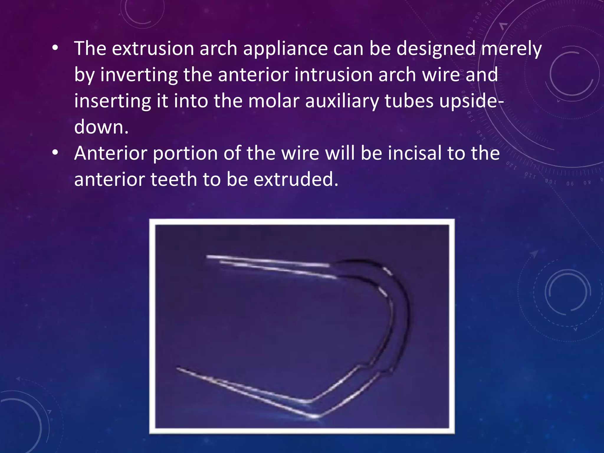 Extrusion arches of Nanda by Dr Maher Fouda | PPTX