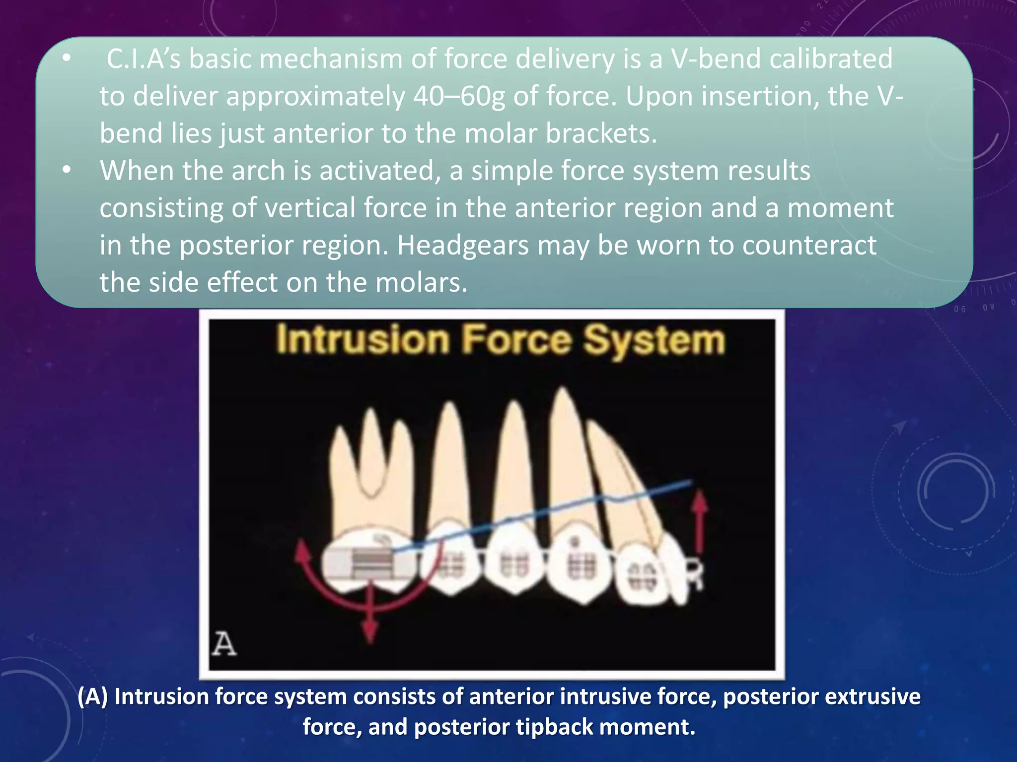 Extrusion arches of Nanda by Dr Maher Fouda | PPTX