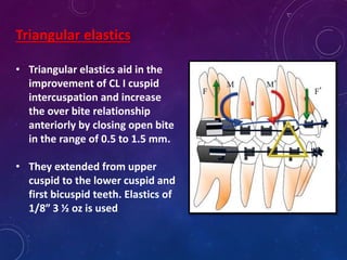 Extrusion arches of Nanda by Dr Maher Fouda | PPTX