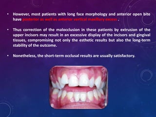 Extrusion arches of Nanda by Dr Maher Fouda | PPTX