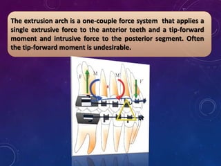 Extrusion arches of Nanda by Dr Maher Fouda | PPTX