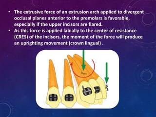 Extrusion arches of Nanda by Dr Maher Fouda | PPTX
