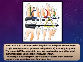 Extrusion arches of Nanda by Dr Maher Fouda | PPTX