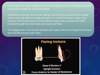 Extrusion arches of Nanda by Dr Maher Fouda | PPTX