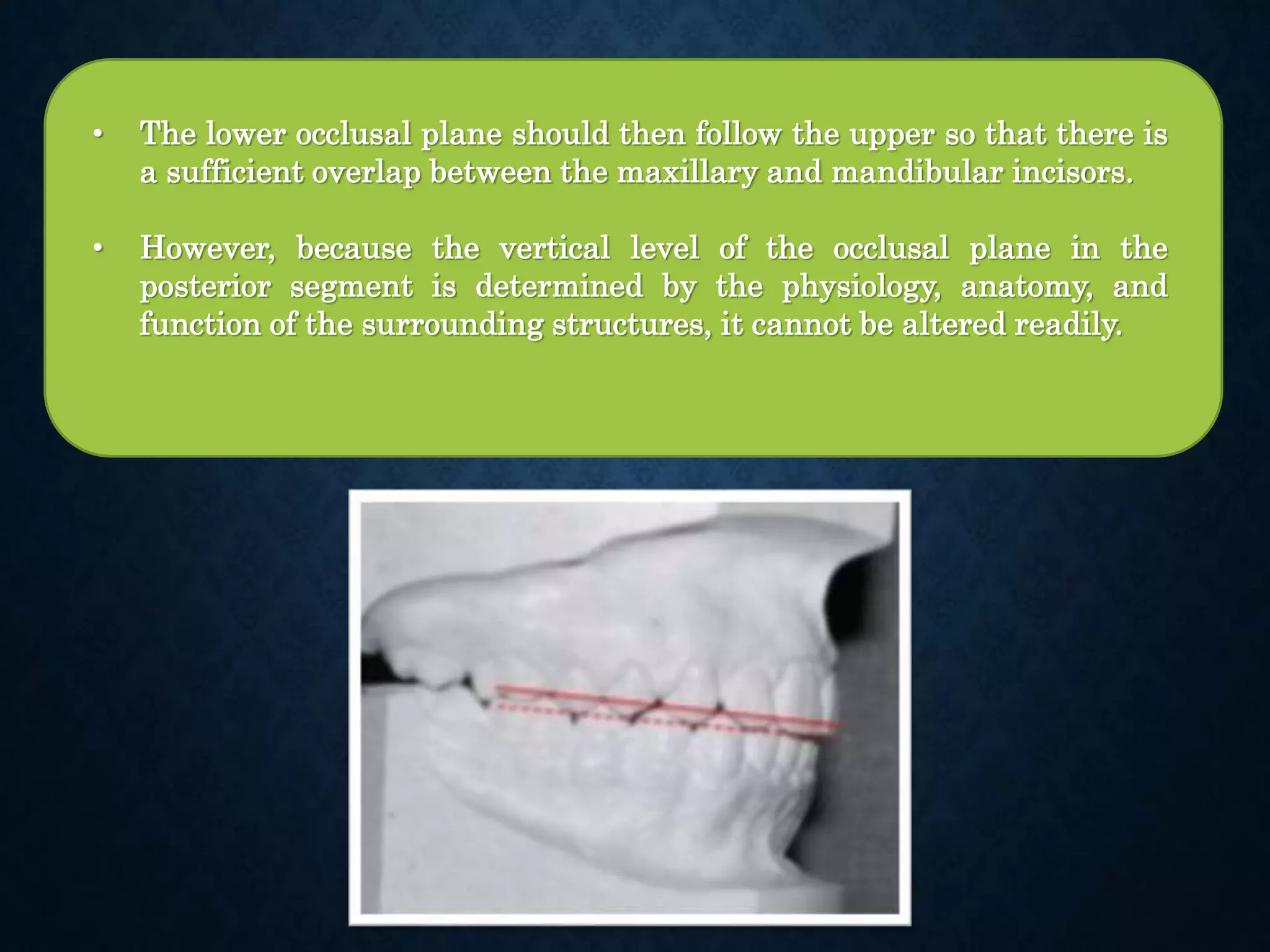 Extrusion by reverse curves archwires by Dr Maher Fouda | PPTX