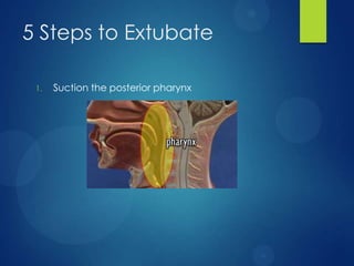 Extubation in pacu#1 | PPTX