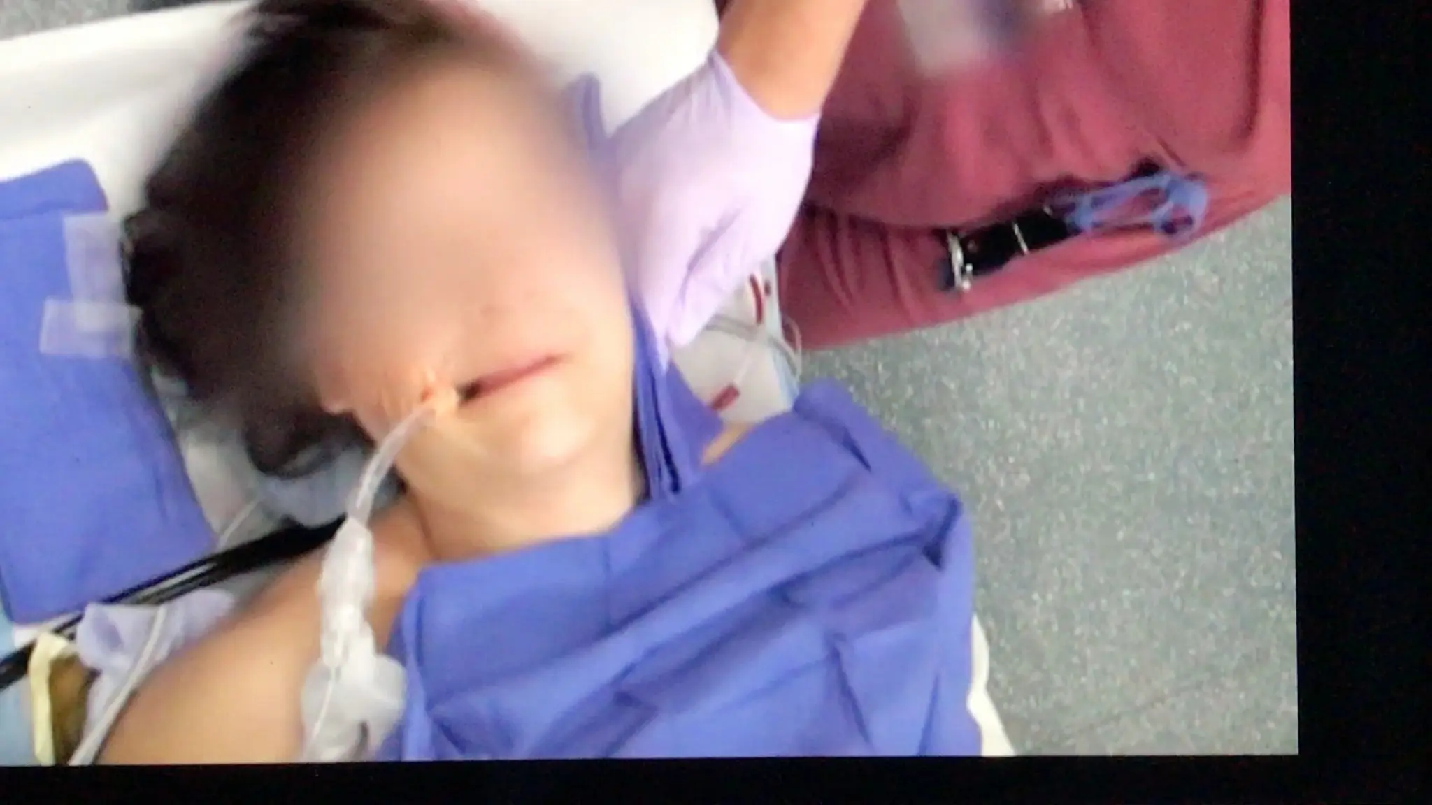 Extubation of difficult airway which includes difficult airway society ...