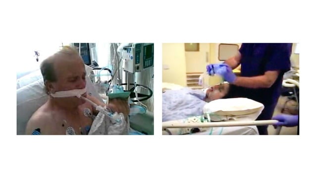 Extubation of difficult airway which includes difficult airway society ...