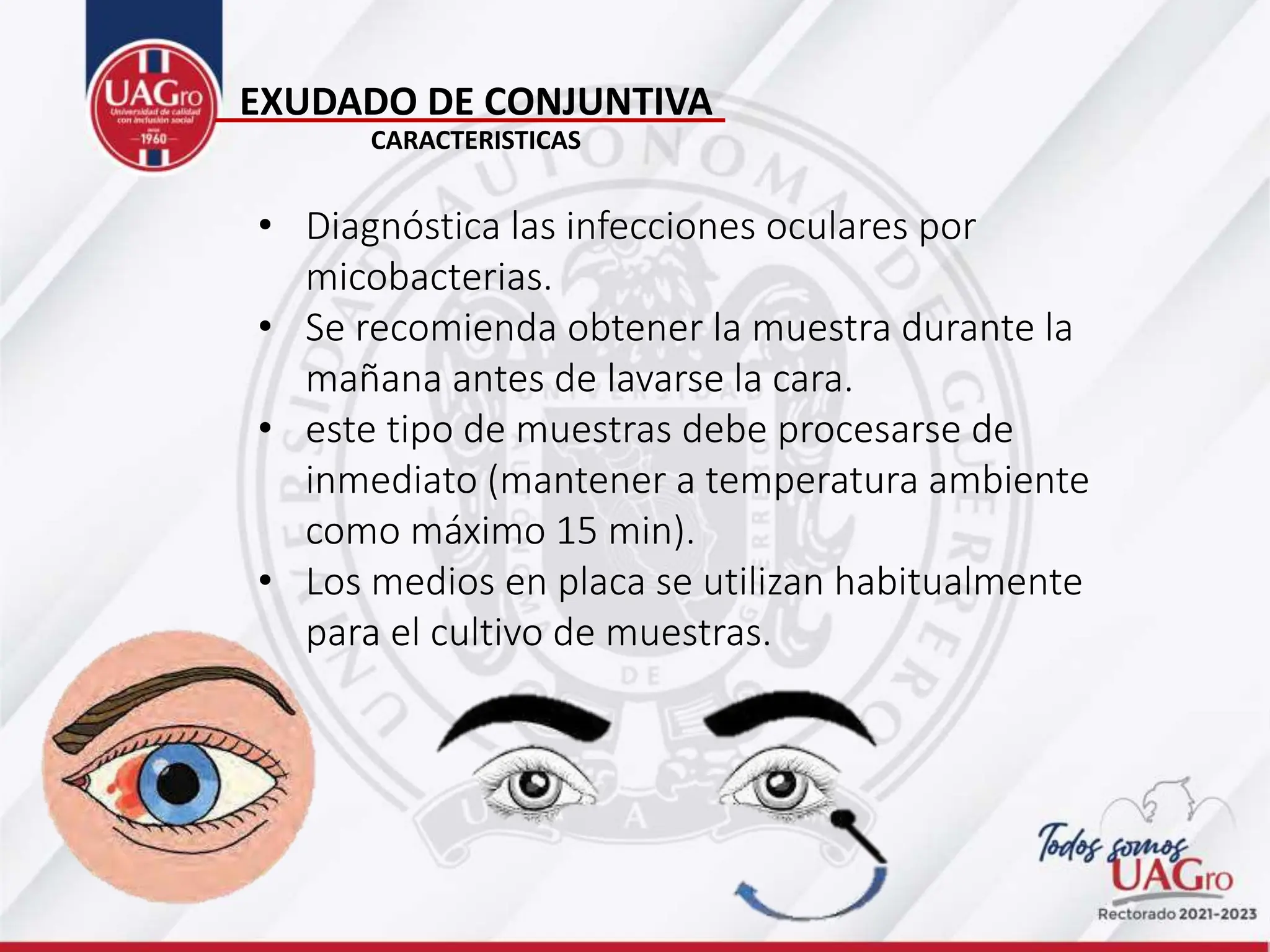 Exudado nasal y de conjuntiva de la medicina | PPTX | Infectious ...