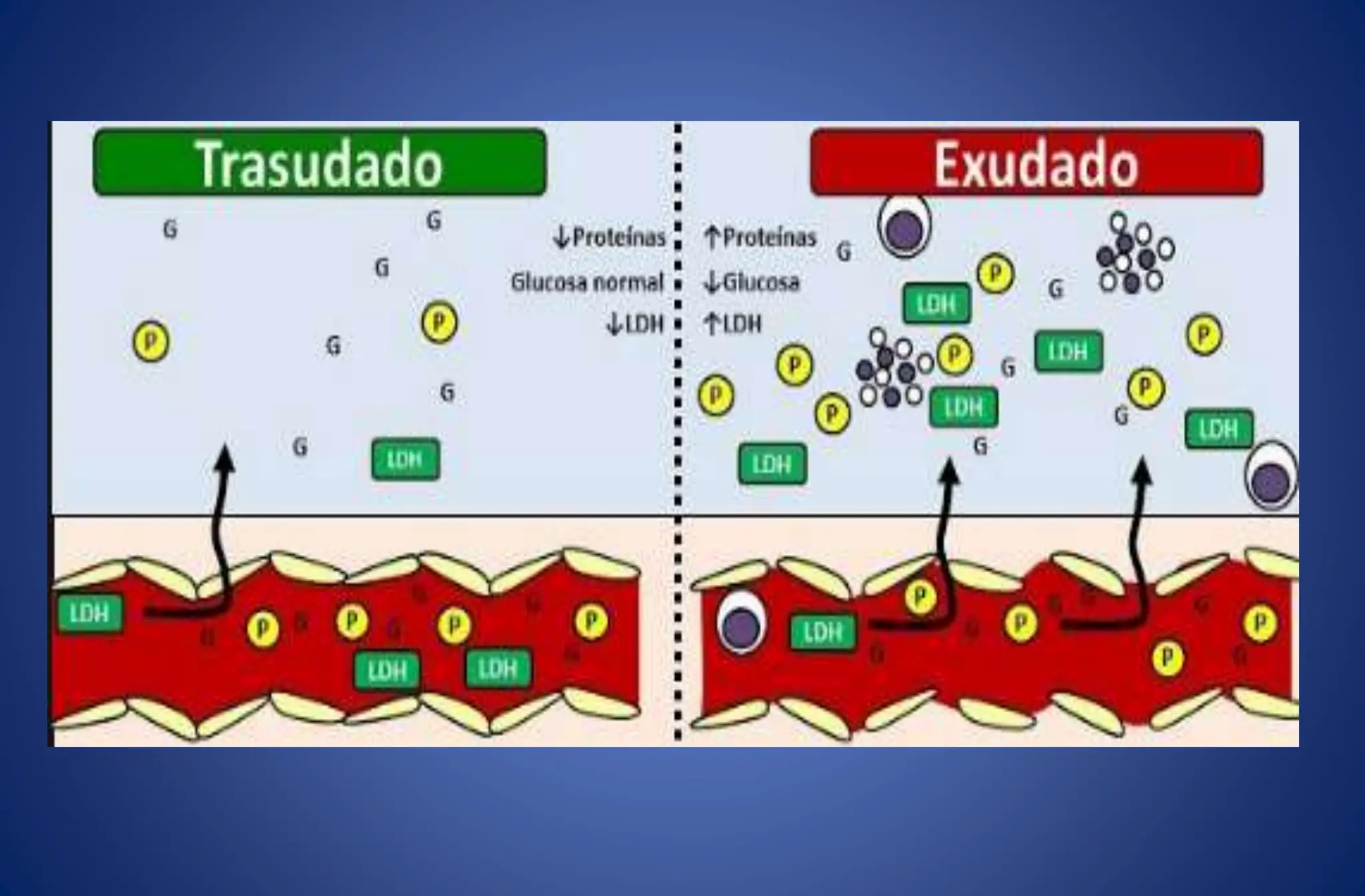 EXUDADO Y TRASUDADO.pptx