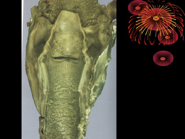 Exudative inflammation | PPT | Digestive Disorders | Diseases and ...