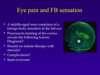 Eye | PPT