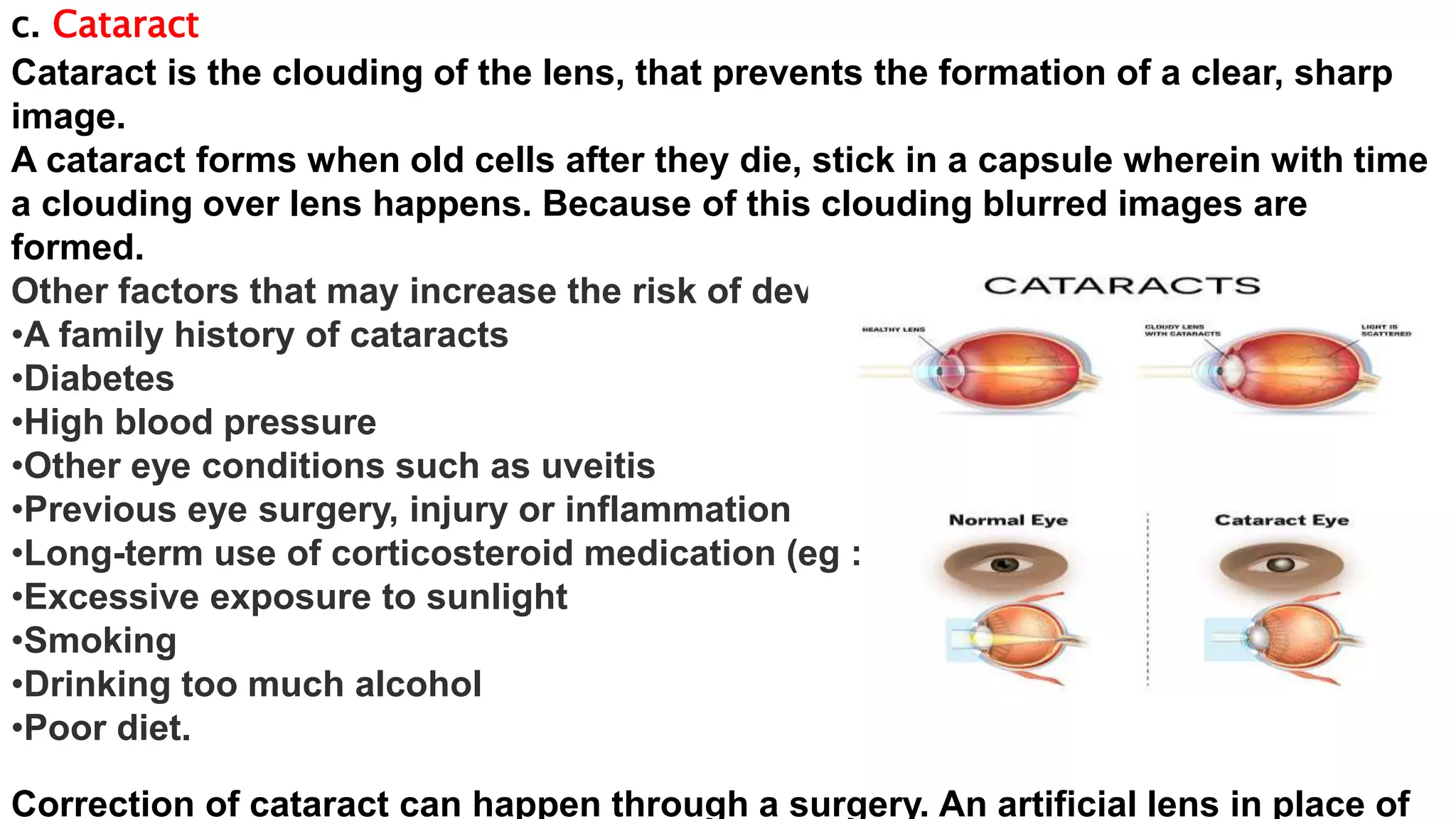 The Human Eye | PPTX
