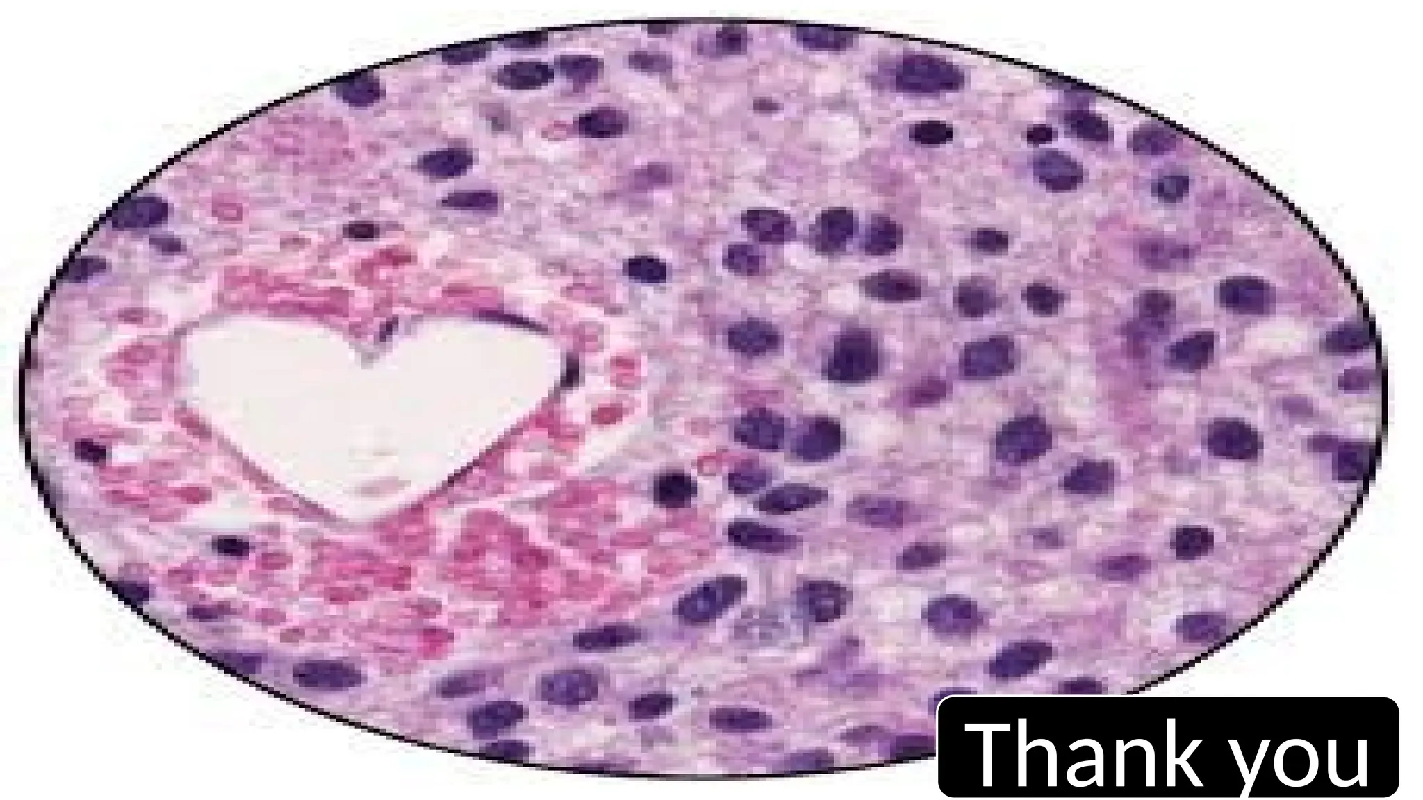 Histology of the eye by a very good docotor in iraqi uni collage of med ...