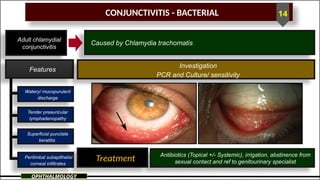 Infections of Eyelid Cornea Conjectiva and Uveitis.pptx
