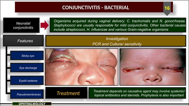Infections of Eyelid Cornea Conjectiva and Uveitis.pptx