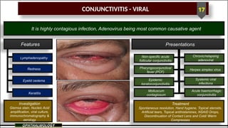 Infections of Eyelid Cornea Conjectiva and Uveitis.pptx