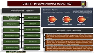 Infections of Eyelid Cornea Conjectiva and Uveitis.pptx